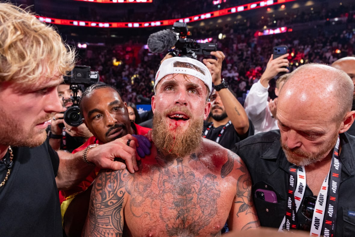 Jake Paul Will Miss All of 2026 After Anthony Joshua Broke His Jaw in ...